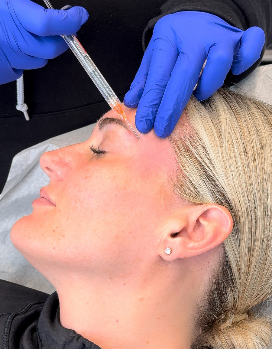 Dermal Fillers – NM Aesthetics Wellness